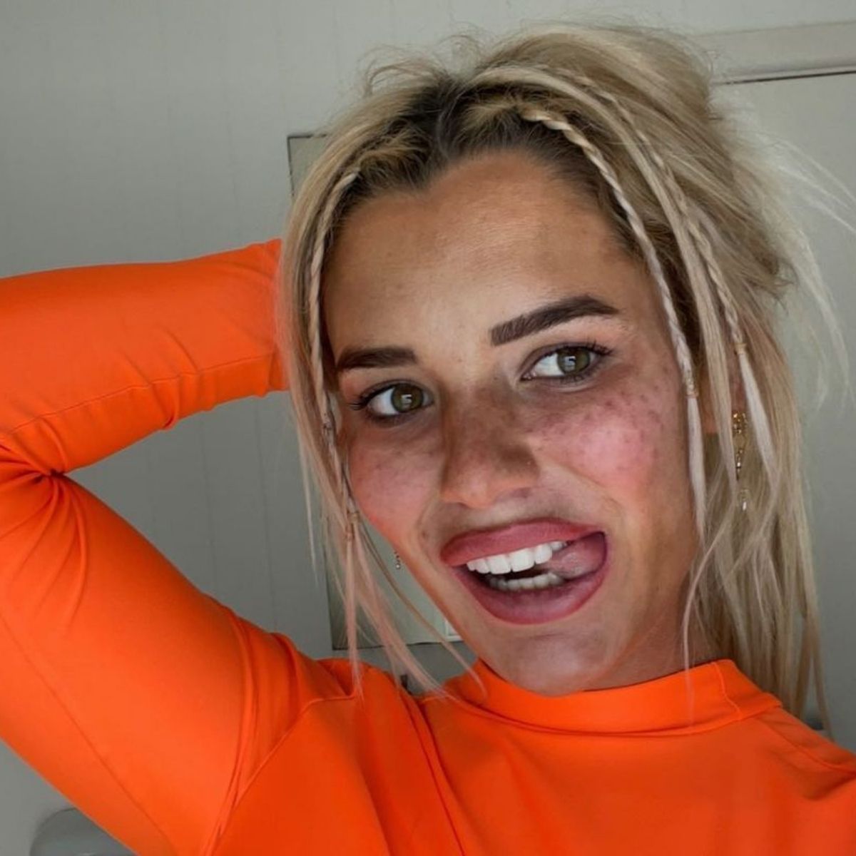 Influencer sufre quemaduras en el rostro tras intentar truco de Tik Tok ...